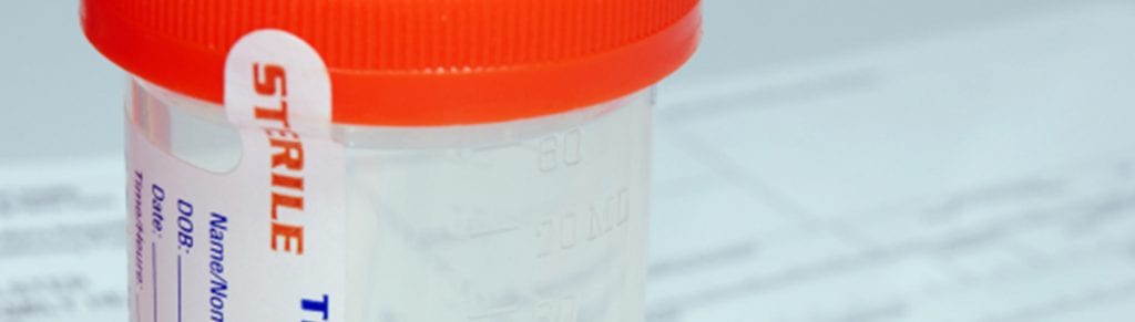 What is detected in a Drug and Alcohol Screen? | KINNECT